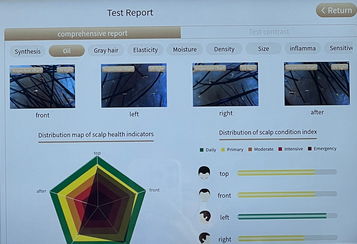 scalp analyzer for API procedure call