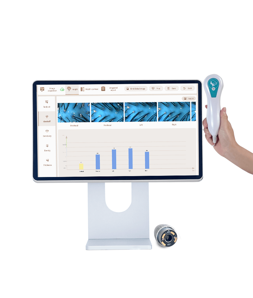 AI scalp analysis for Hair loss scalp diagnosis
